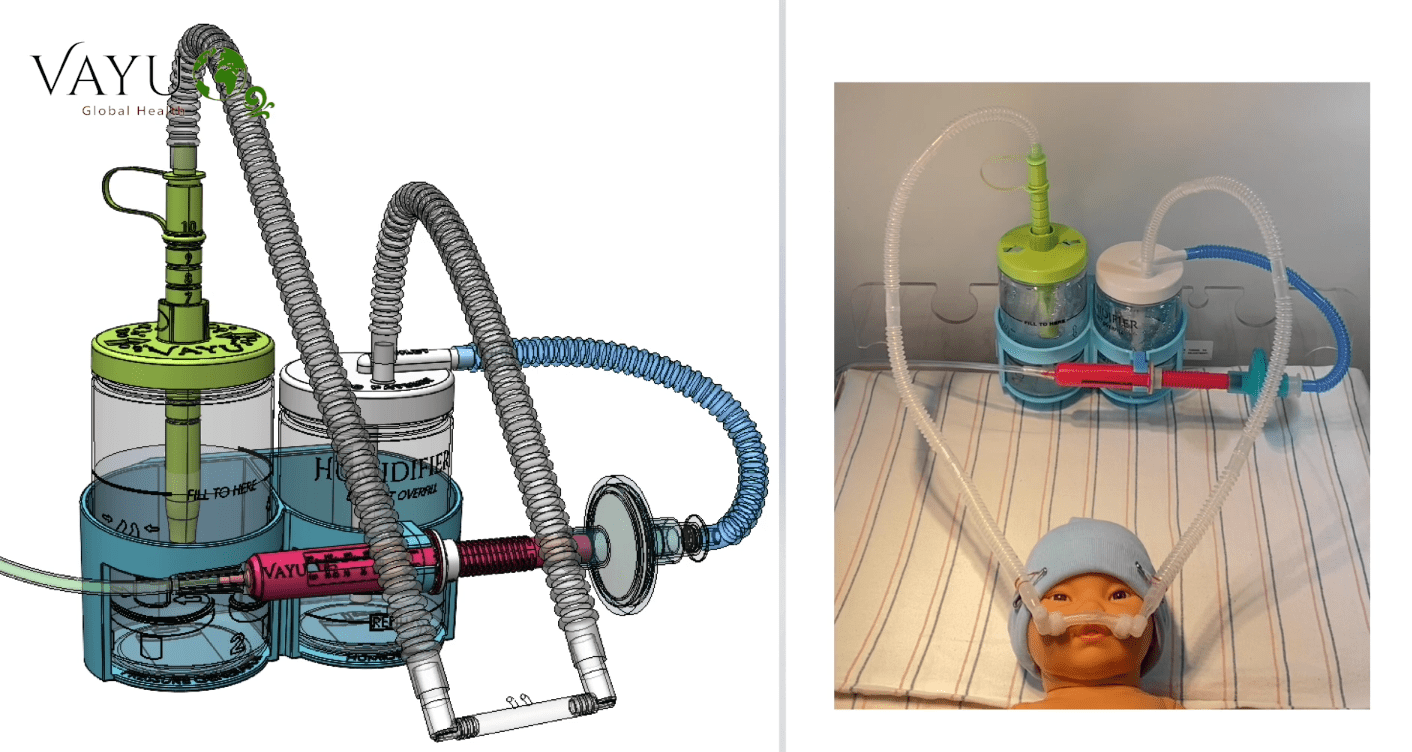 Vayu bubble CPAP System – Star Chain